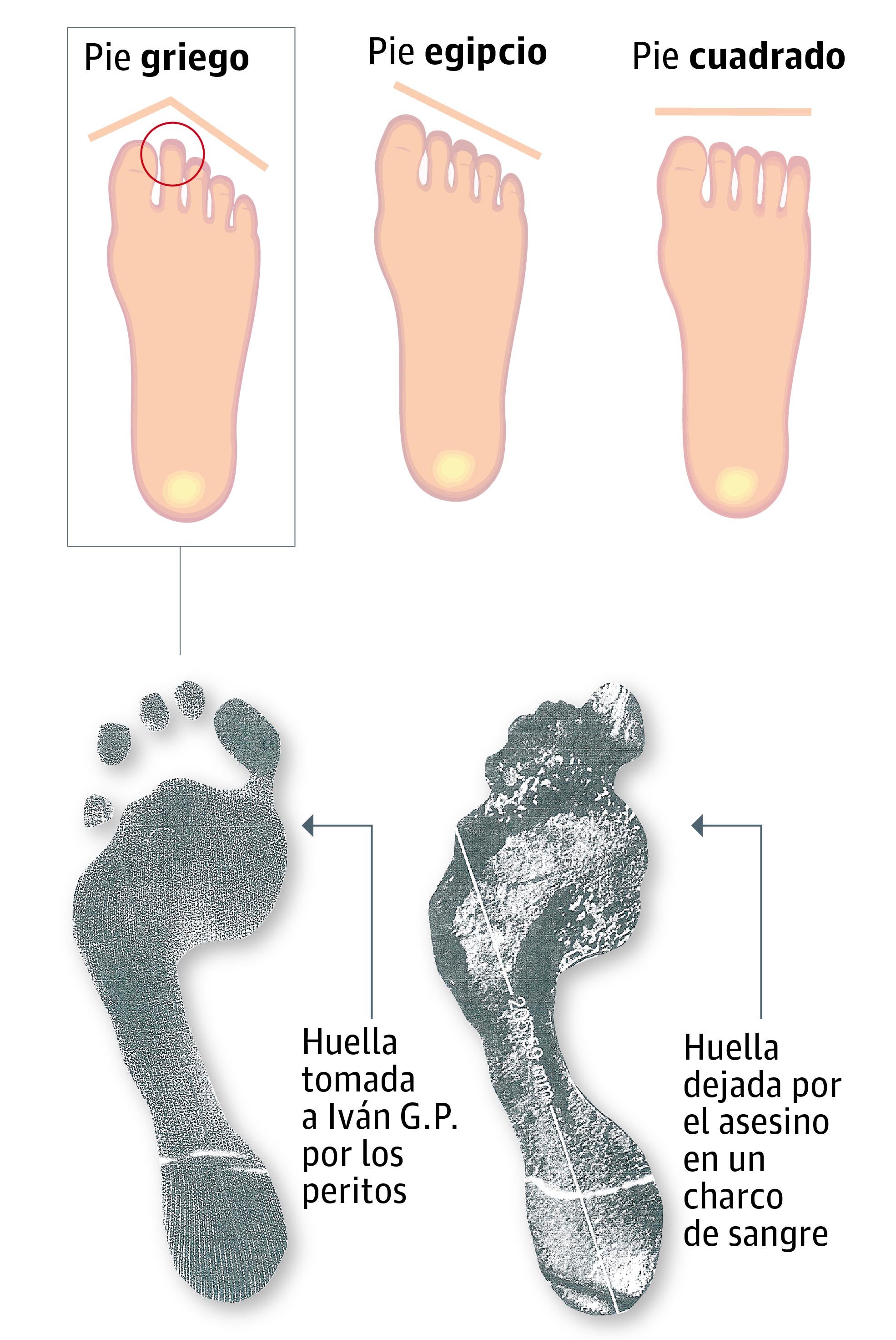 Un pie griego señala a Iván | La Verdad